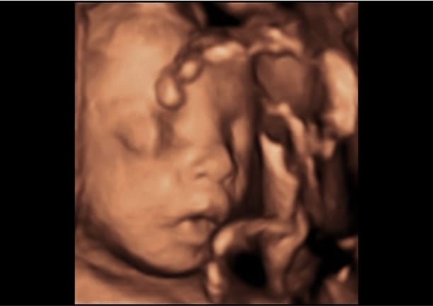 2D vs. 3D vs. 4D Ultrasounds | Discover the Difference